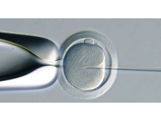 Olympus IVF Solutions | 奥林巴斯生物显微镜