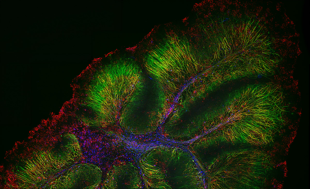 FV4000 | Confocal Laser Scanning Microscope | 奥林巴斯生物显微镜