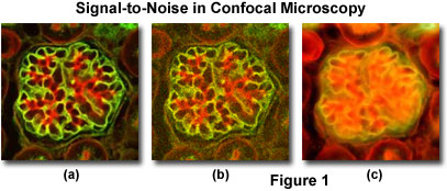 Confocal Microscopy - Signal-to-Noise Considerations | 奥林巴斯生物显微镜