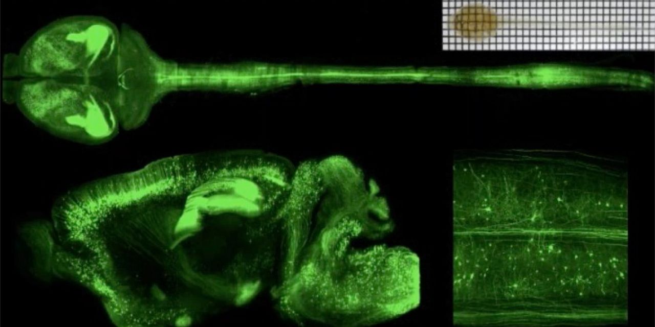 Tissue Optical Clearing Imaging: From In Vitro to In Vivo | 奥林巴斯生物显微镜