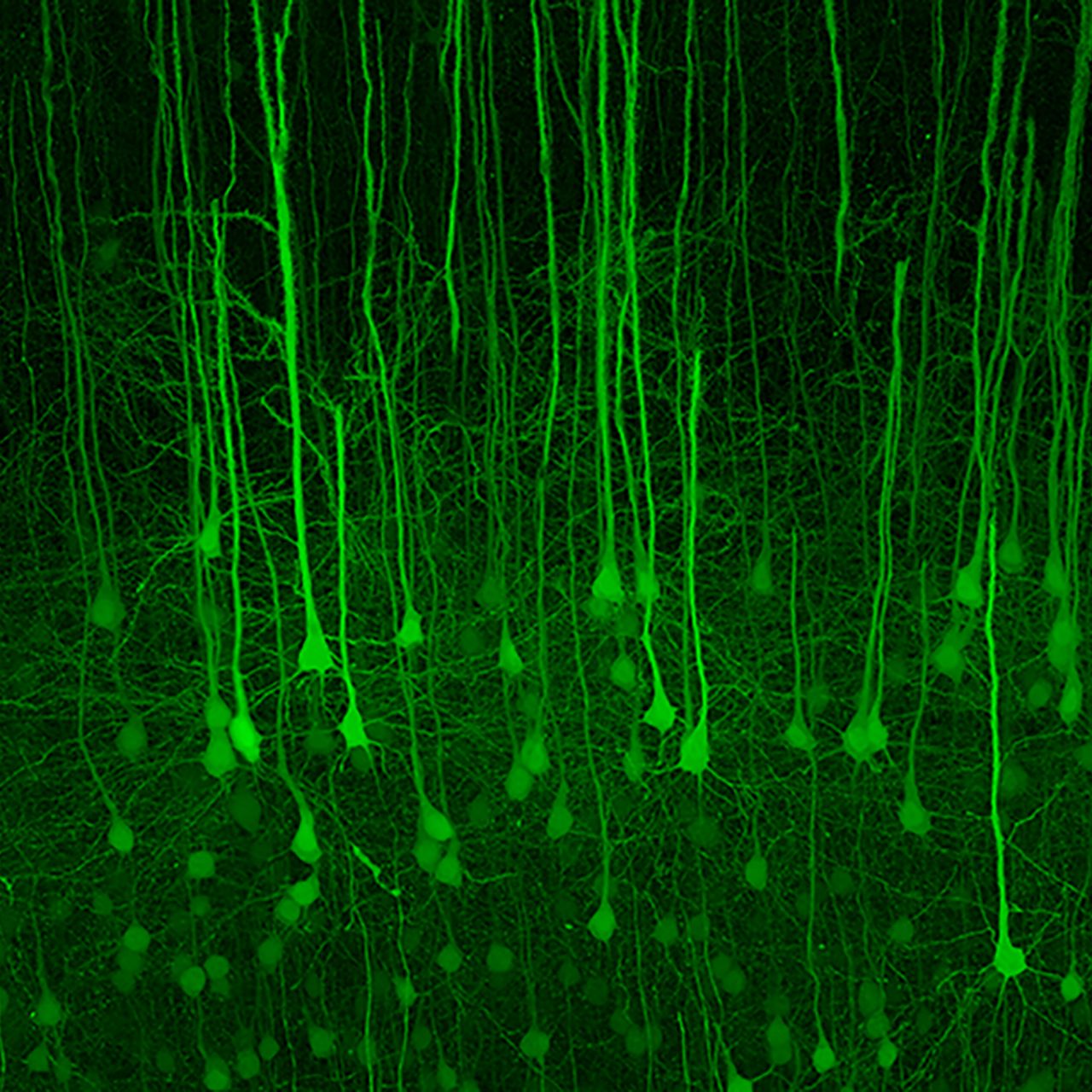 FV5000 Confocal Laser Scanning Microscope | 奥林巴斯生物显微镜