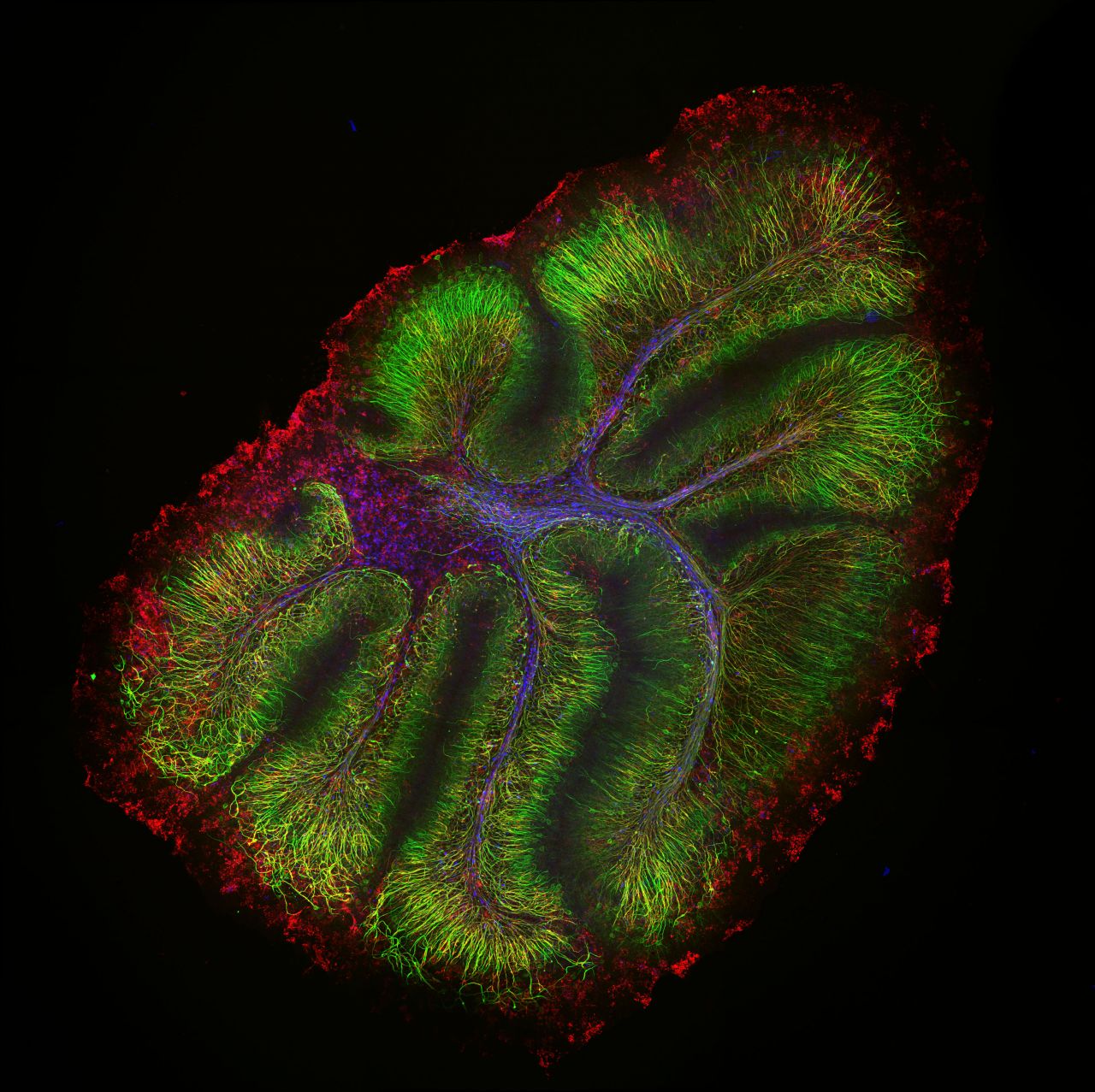 SilVIR Detector | 奥林巴斯生物显微镜