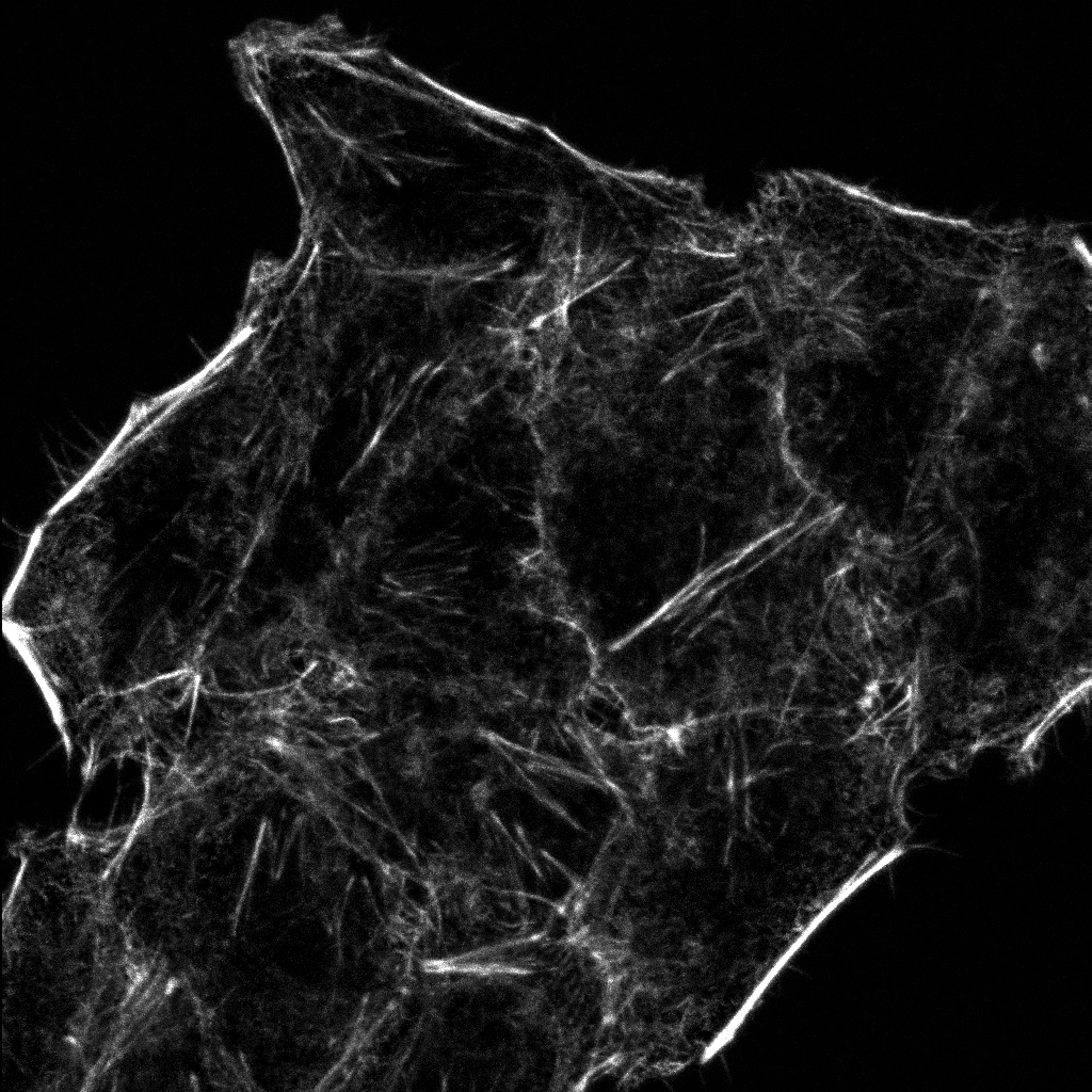 FV4000 | Confocal Laser Scanning Microscope | 奥林巴斯生物显微镜