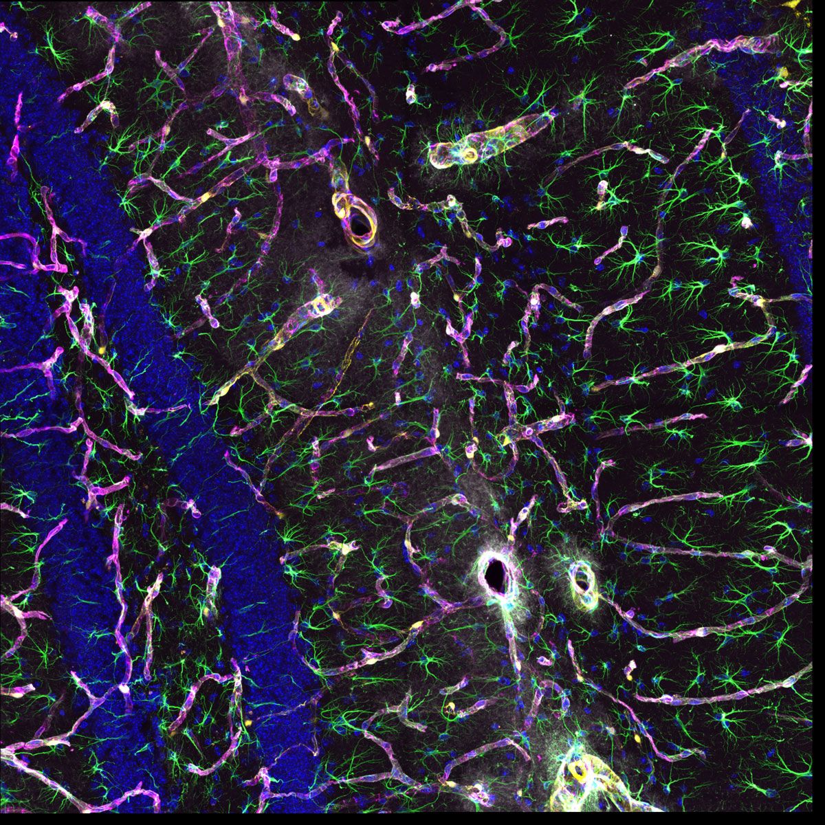 FV4000 | Confocal Laser Scanning Microscope | 奥林巴斯生物显微镜